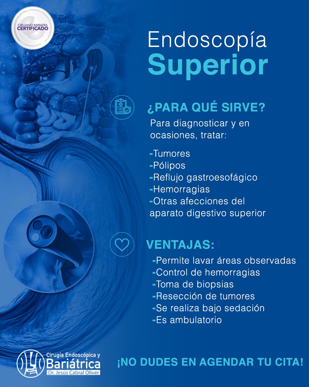 ¿En qué consiste la endoscopía superior? – Endoscopica y Bariatrica Dr ...